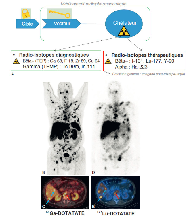 Injections De Rayonnement De Bore Pour Le Cancer